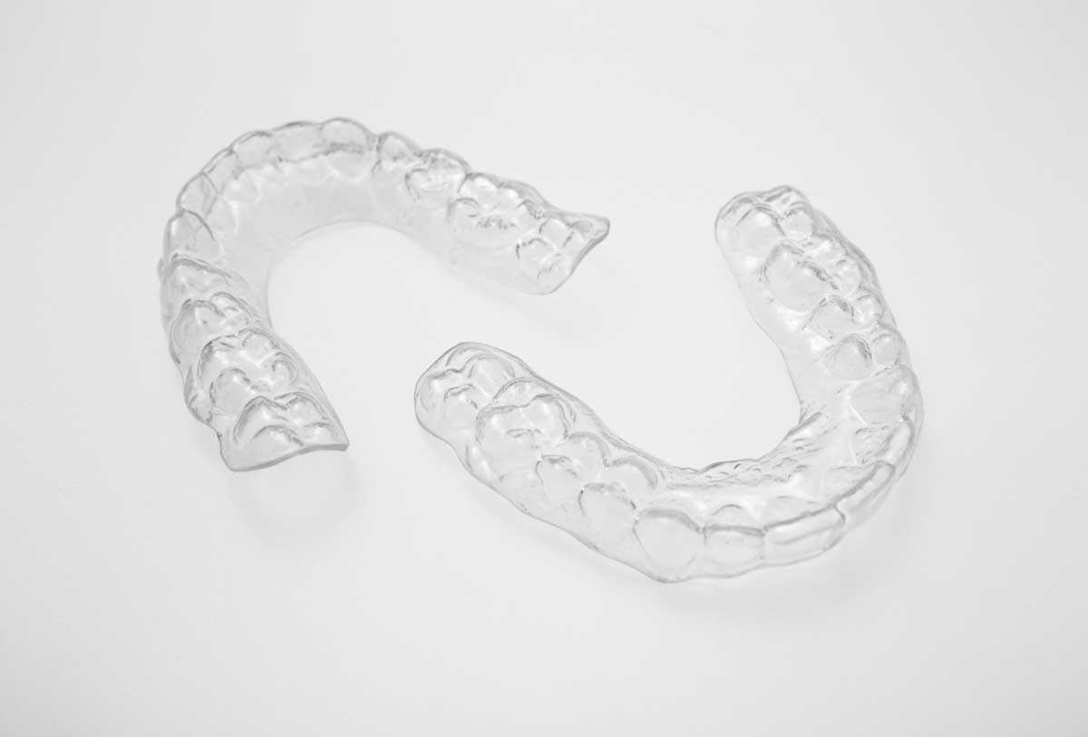 Retencija - kako očuvati rezultat ortodoncije - Stomatološka ...